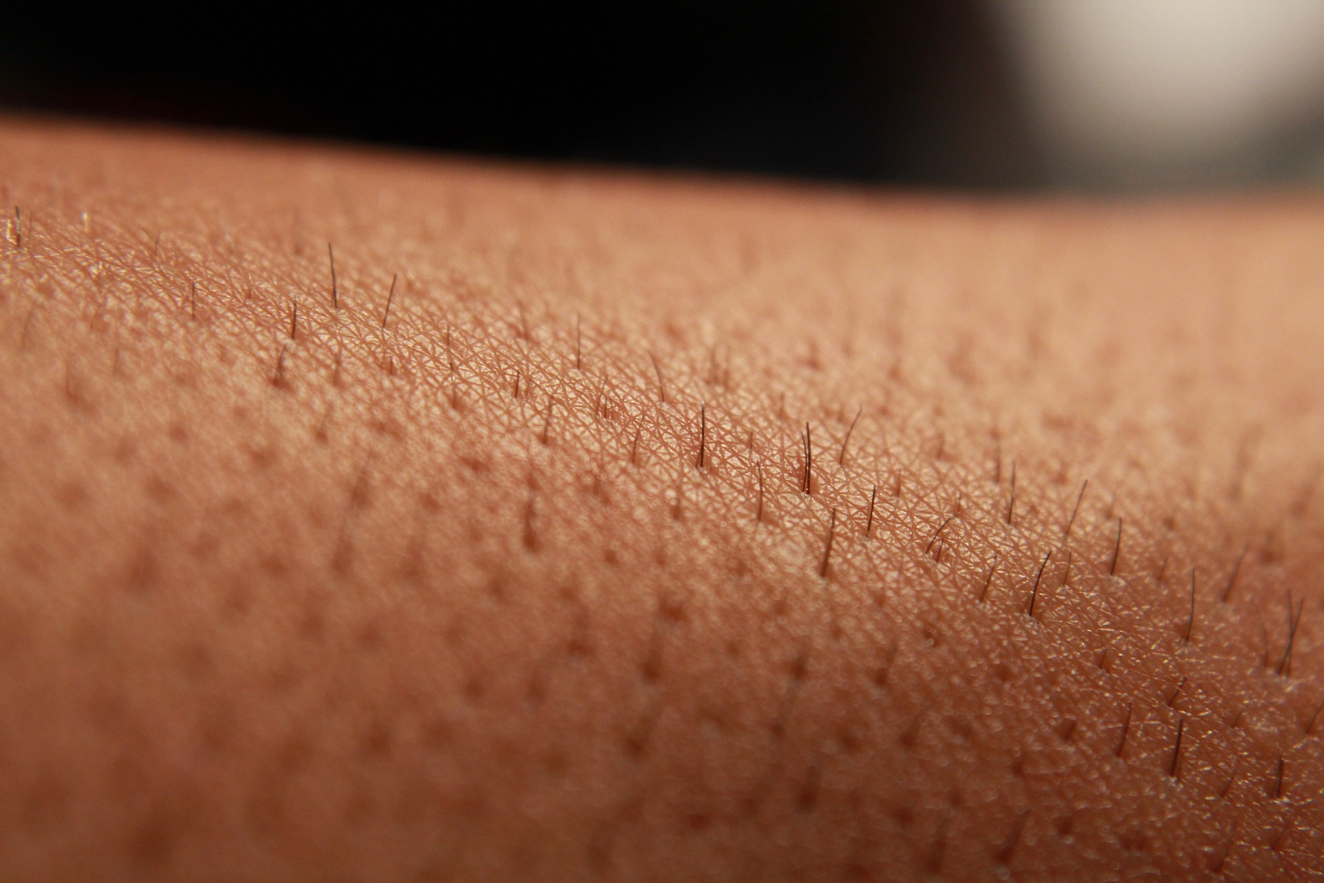 Understanding Folliculitis Inflamed Hair Follicles Dermatology Understanding Folliculitis Inflamed Hair Follicles Dermatology